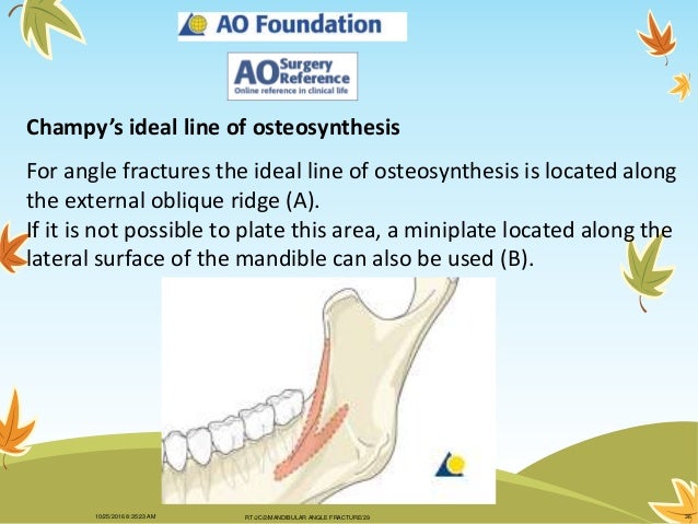 Dr Rahul VC Tiwari - Oral & Maxillofacial Surgery - SIBAR Institute o…