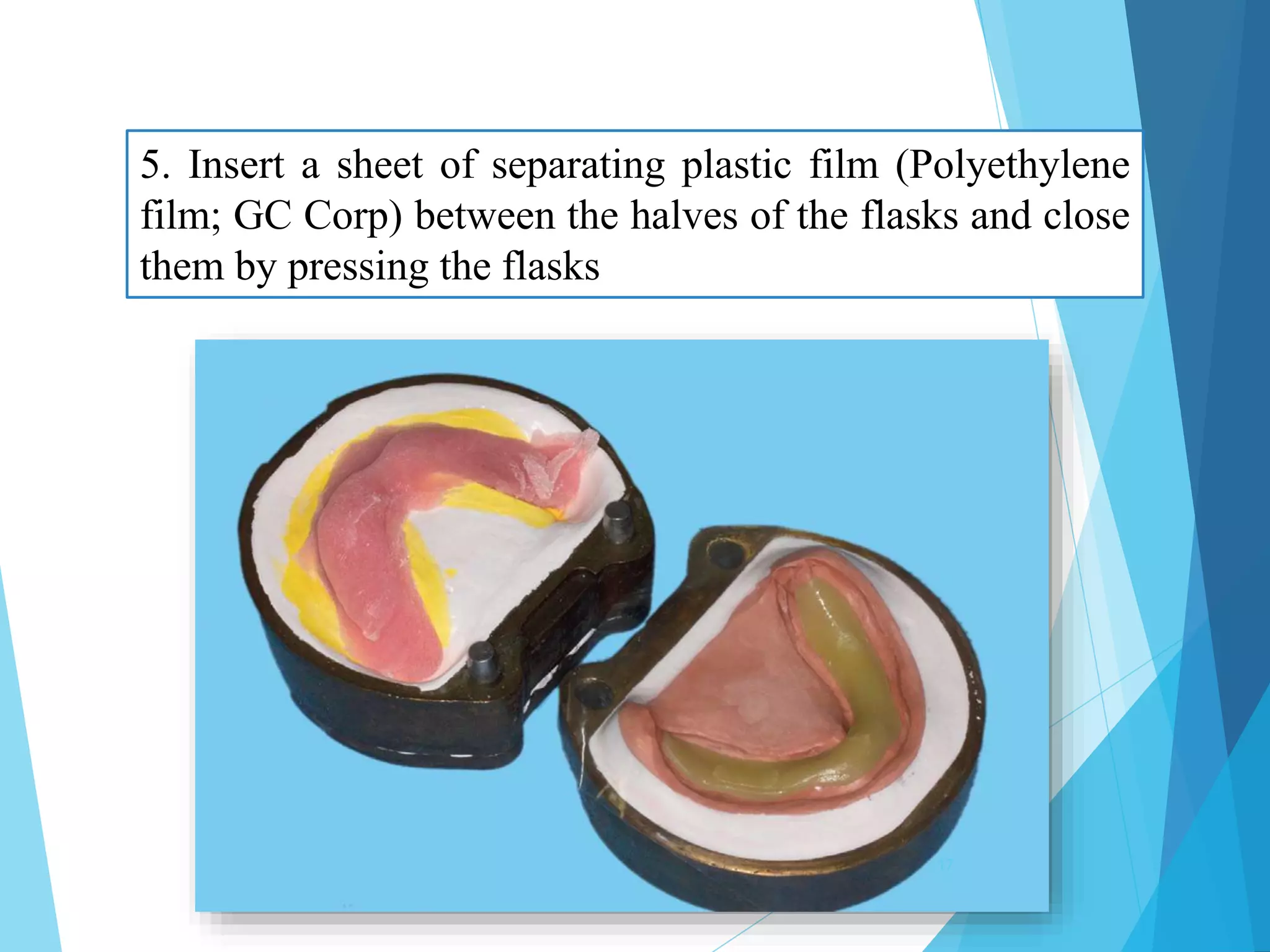 Journal Club for prosthodontics | PPTX