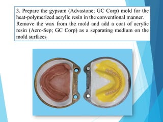 Journal Club for prosthodontics | PPTX