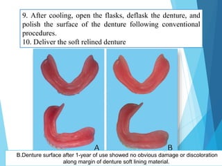 Journal Club for prosthodontics | PPTX