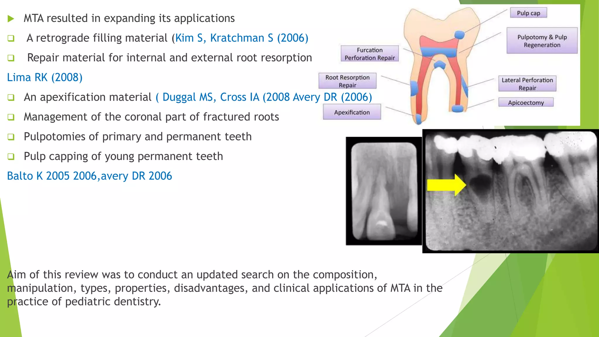 MTA USE IN PEDIATRIC DENTISTRY: LITERATURE REVIEW | PPTX