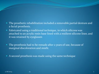 Journal Club presentation for maxillofacial prosthesis | PPTX | Dental ...
