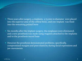 Journal Club presentation for maxillofacial prosthesis | PPTX