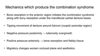 Journal club on the classic article of Combination Syndrome | PPTX