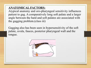 Etiology and Management of Gag Reflex in the Prosthodontic Clinic | PPTX