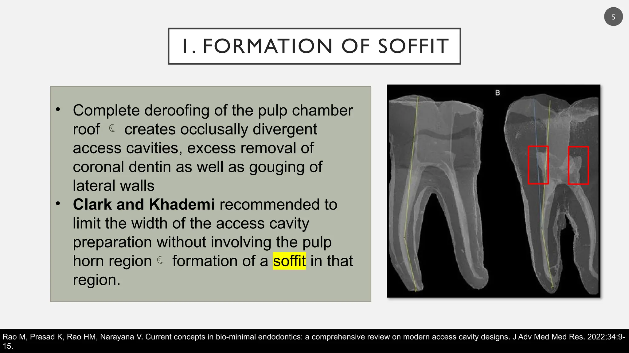 journal club presented minimally invasive endodontics | PPTX