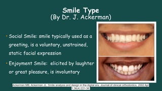 Journal club on gummy smile presentation.pptx