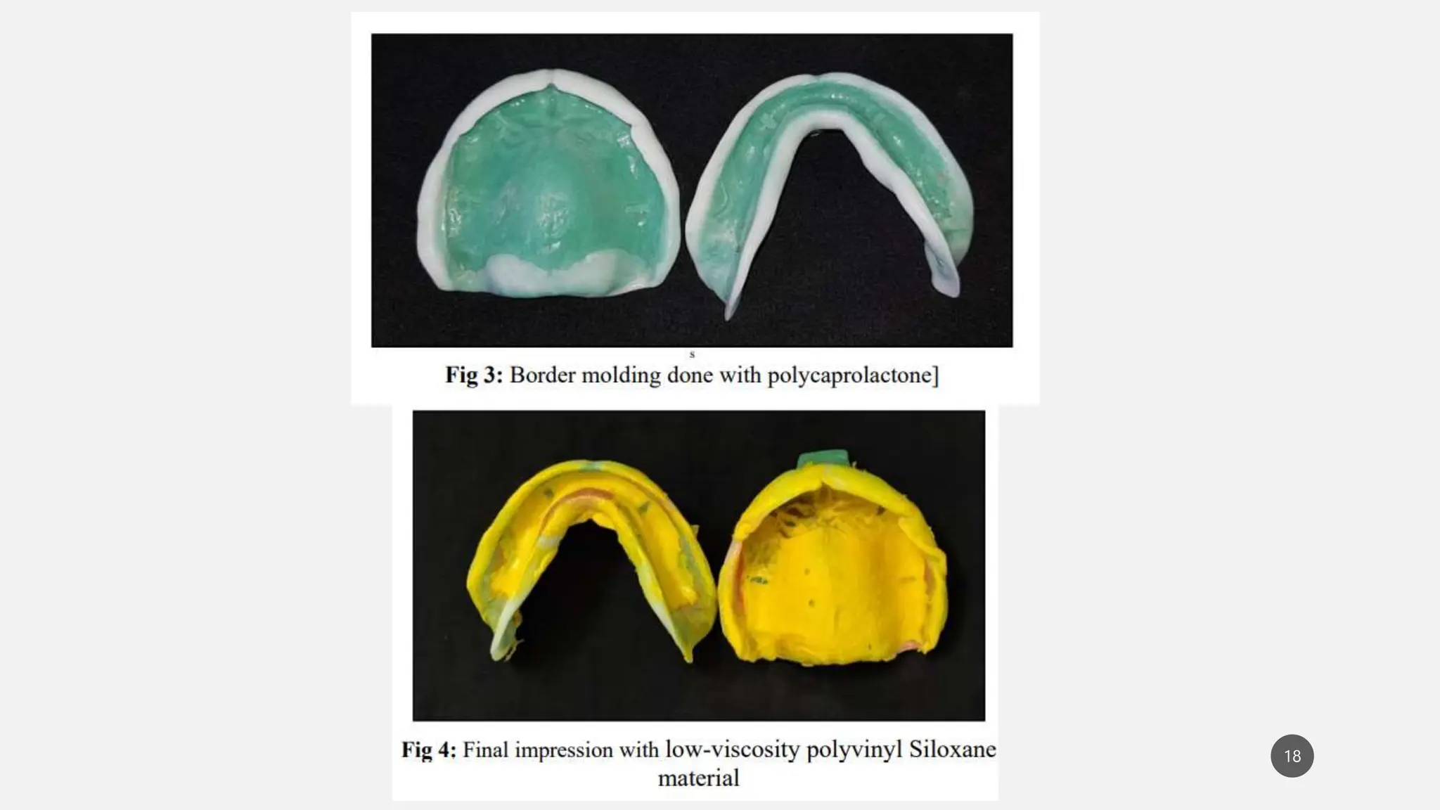 modified technique for single step border molding.pptx
