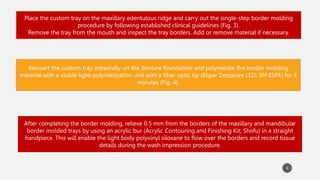 modified technique for single step border molding.pptx