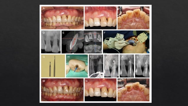 LIMITATION AND MANAGEMENT OF DYNEMIC SYSTEM FOR LOCATING CALCIFIED CANALYNEMIC NAVIGATION SYSTEM ...