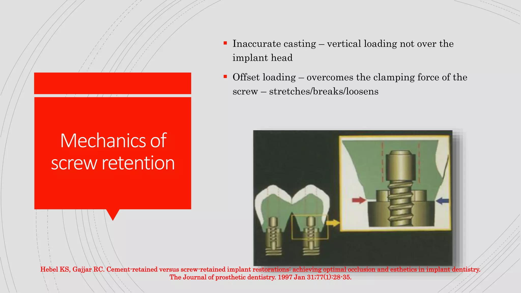 Screw vs cement retained implant prosthesis | PPTX