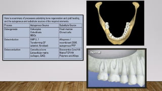 bone grafts and substitutes | PPTX