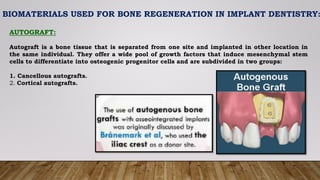 bone grafts and substitutes | PPTX