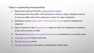 Is Zygomatic Osteotomy a Viable Option to Achieve Symmetry and ...