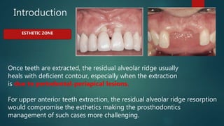 JOURNAL CLUB PRESENTATION IN PROSTHODONTICS ON PLATELET RICH FACTOR | PPTX