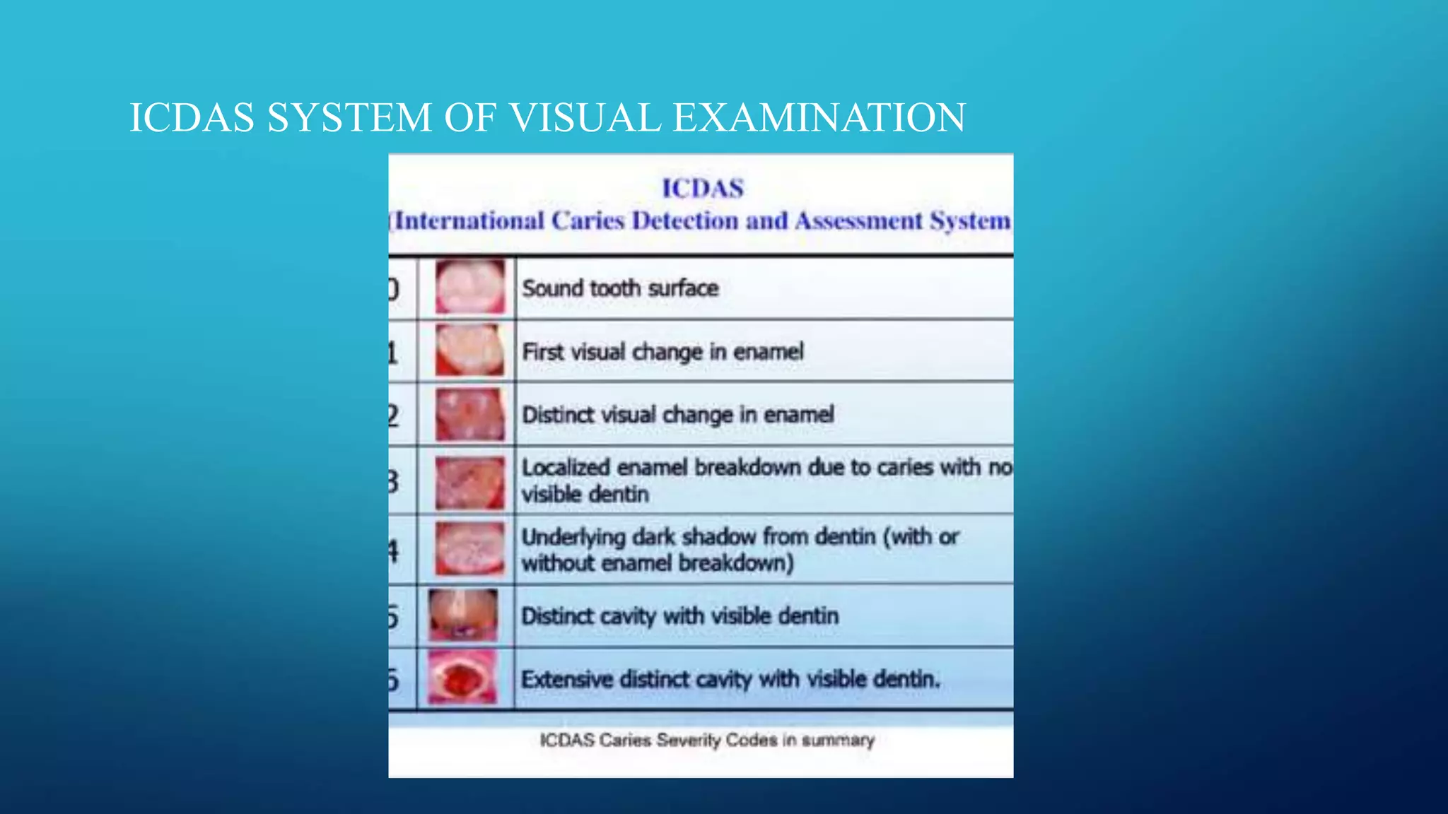 Artificial intelligence in Caries Diagnosis | PPTX