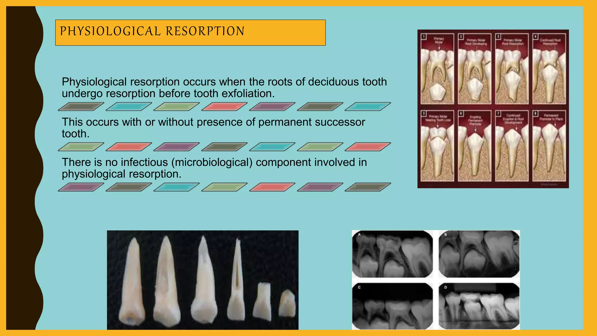 multiple idiopathic external and internal resorption- Dr Sanjana ...