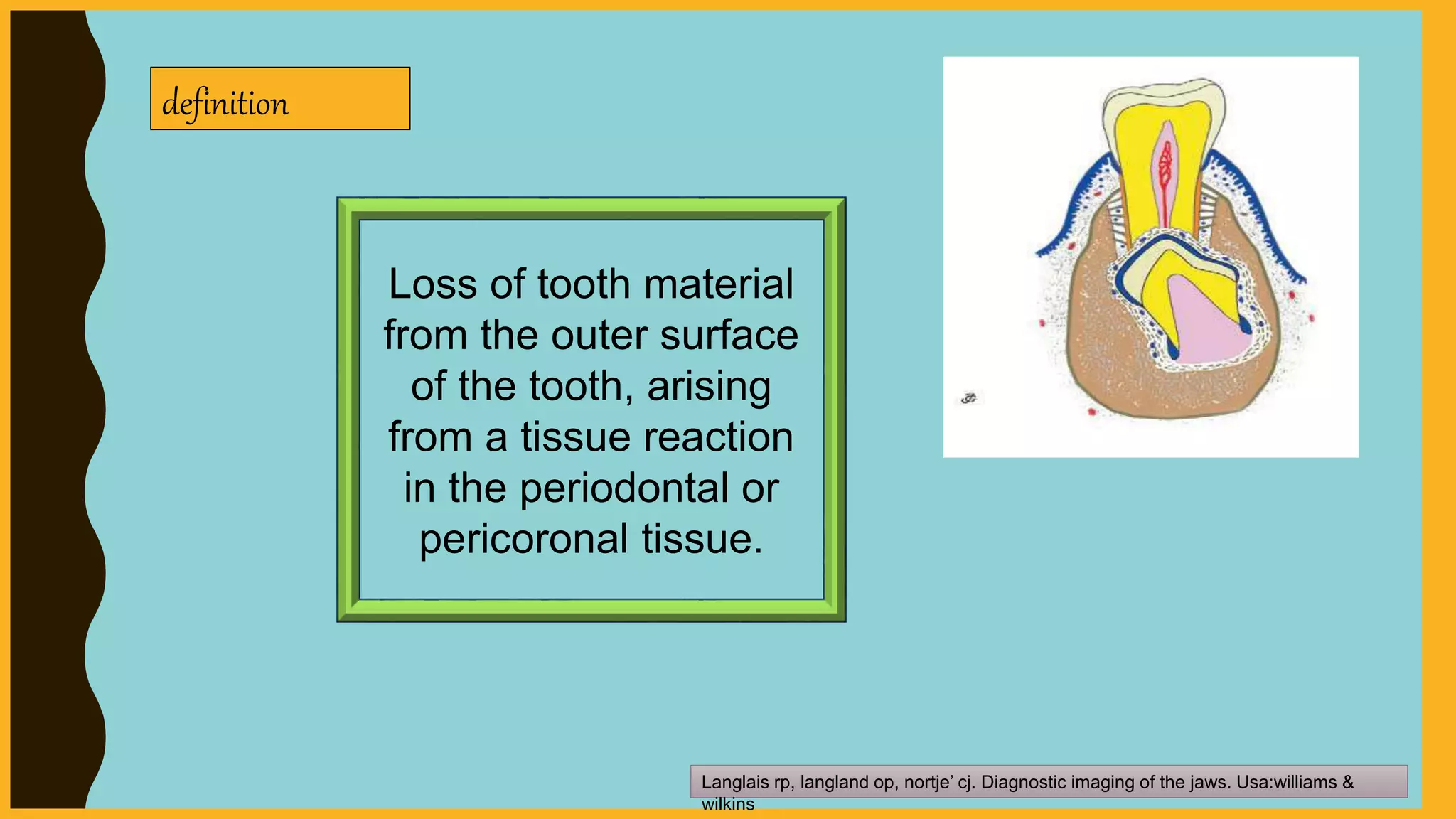 multiple idiopathic external and internal resorption- Dr Sanjana ...