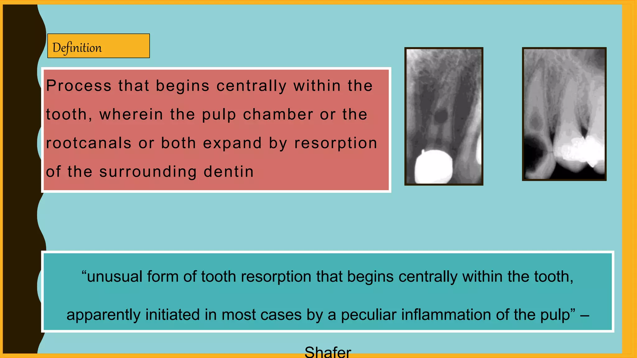 multiple idiopathic external and internal resorption- Dr Sanjana ...