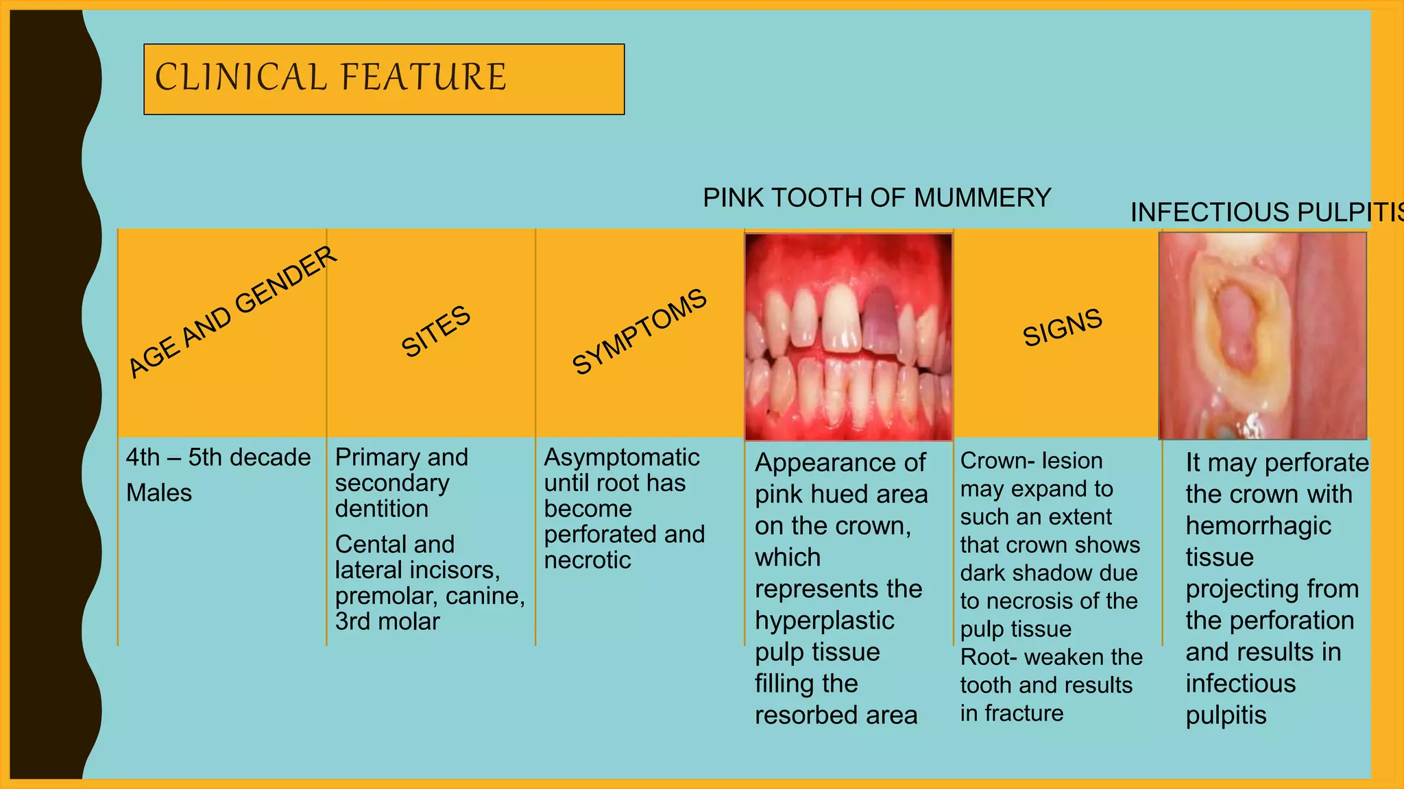 multiple idiopathic external and internal resorption- Dr Sanjana ...