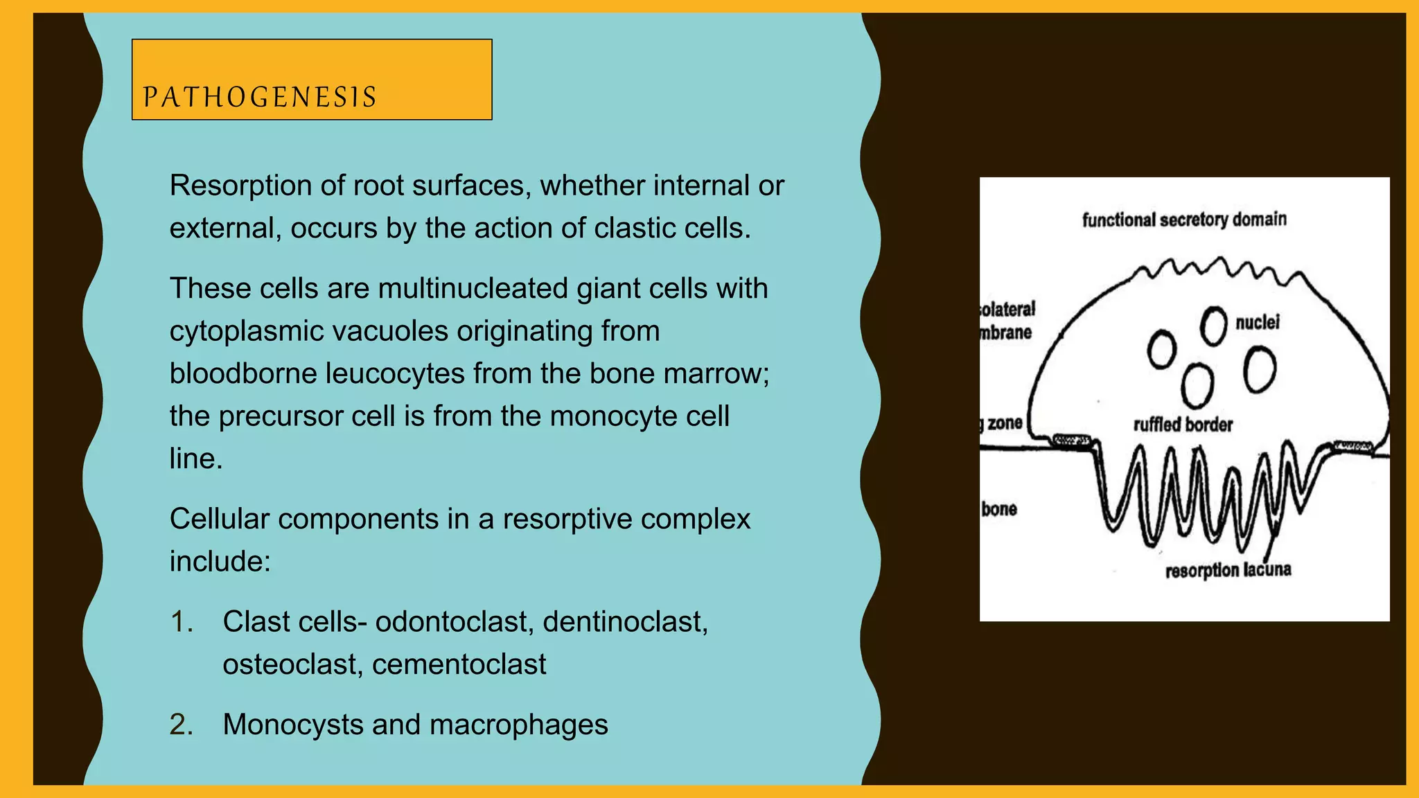 multiple idiopathic external and internal resorption- Dr Sanjana ...