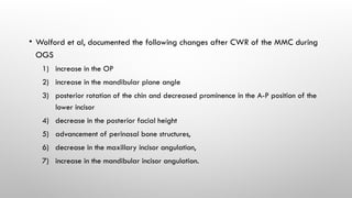 Does Clockwise Rotation of Maxillomandibular Complex Using Surgery ...