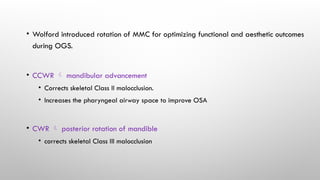 Does Clockwise Rotation of Maxillomandibular Complex Using Surgery ...