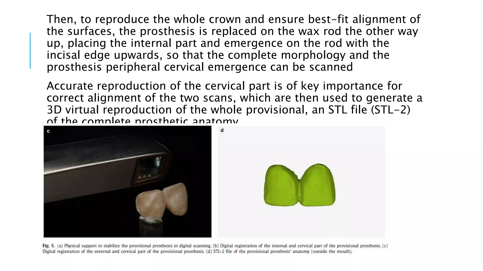 JOURNAL CLUB PRESENTATION IN PROSTHODONTICS on biologically oriented ...