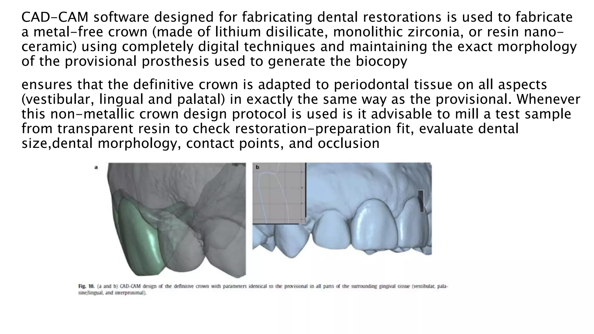 JOURNAL CLUB PRESENTATION IN PROSTHODONTICS on biologically oriented ...