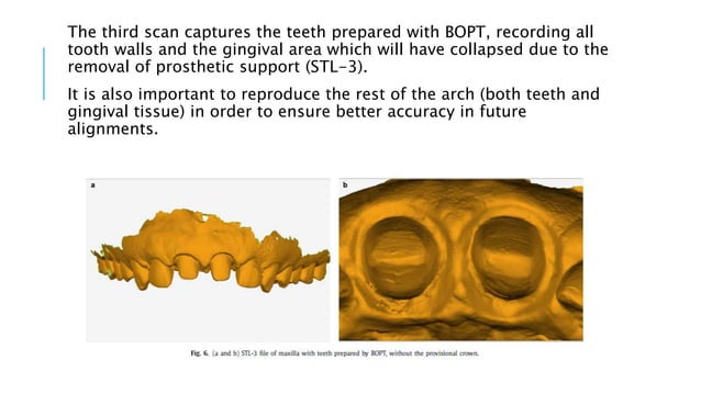 JOURNAL CLUB PRESENTATION IN PROSTHODONTICS on biologically oriented ...