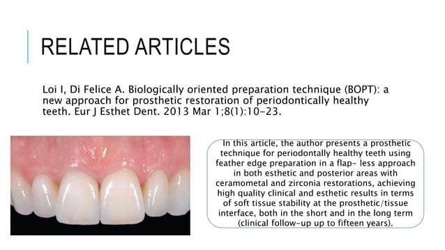 JOURNAL CLUB PRESENTATION IN PROSTHODONTICS on biologically oriented ...