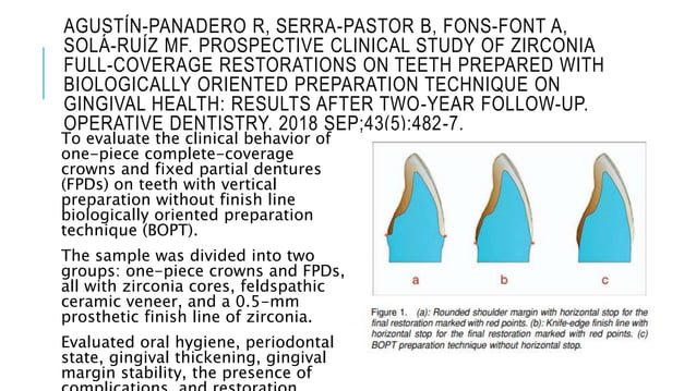 JOURNAL CLUB PRESENTATION IN PROSTHODONTICS on biologically oriented ...