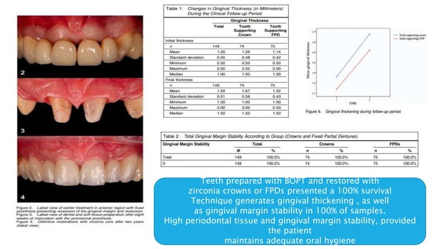JOURNAL CLUB PRESENTATION IN PROSTHODONTICS on biologically oriented ...