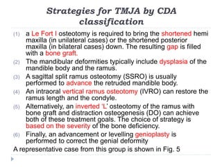New Clinical Classification & Treatment Strategies For TMJ Ankylosis | PPTX