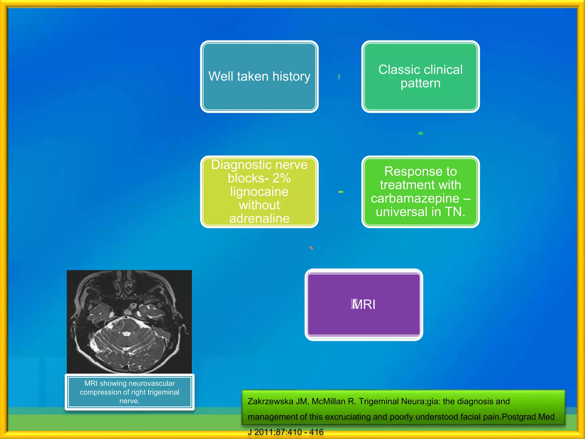 Trigeminal neuralgia - Dr Sanjana Ravindra | PPTX | Brain and Nervous ...