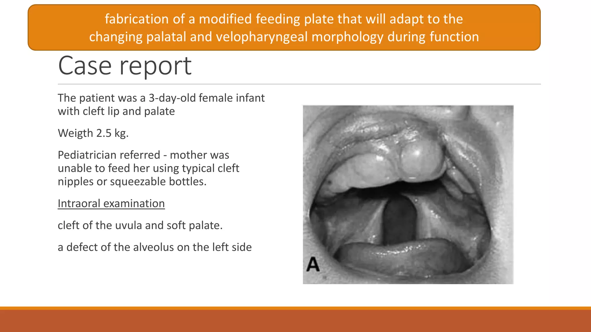 JOURNAL CLUB PRESENTATION IN PROSTHODONTICS ON FEEDING APPLIANCES USED ...