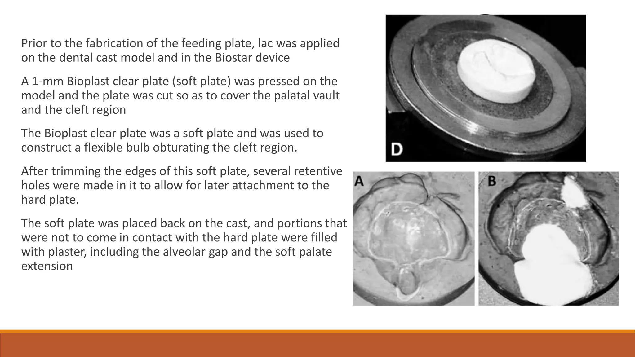 JOURNAL CLUB PRESENTATION IN PROSTHODONTICS ON FEEDING APPLIANCES USED ...