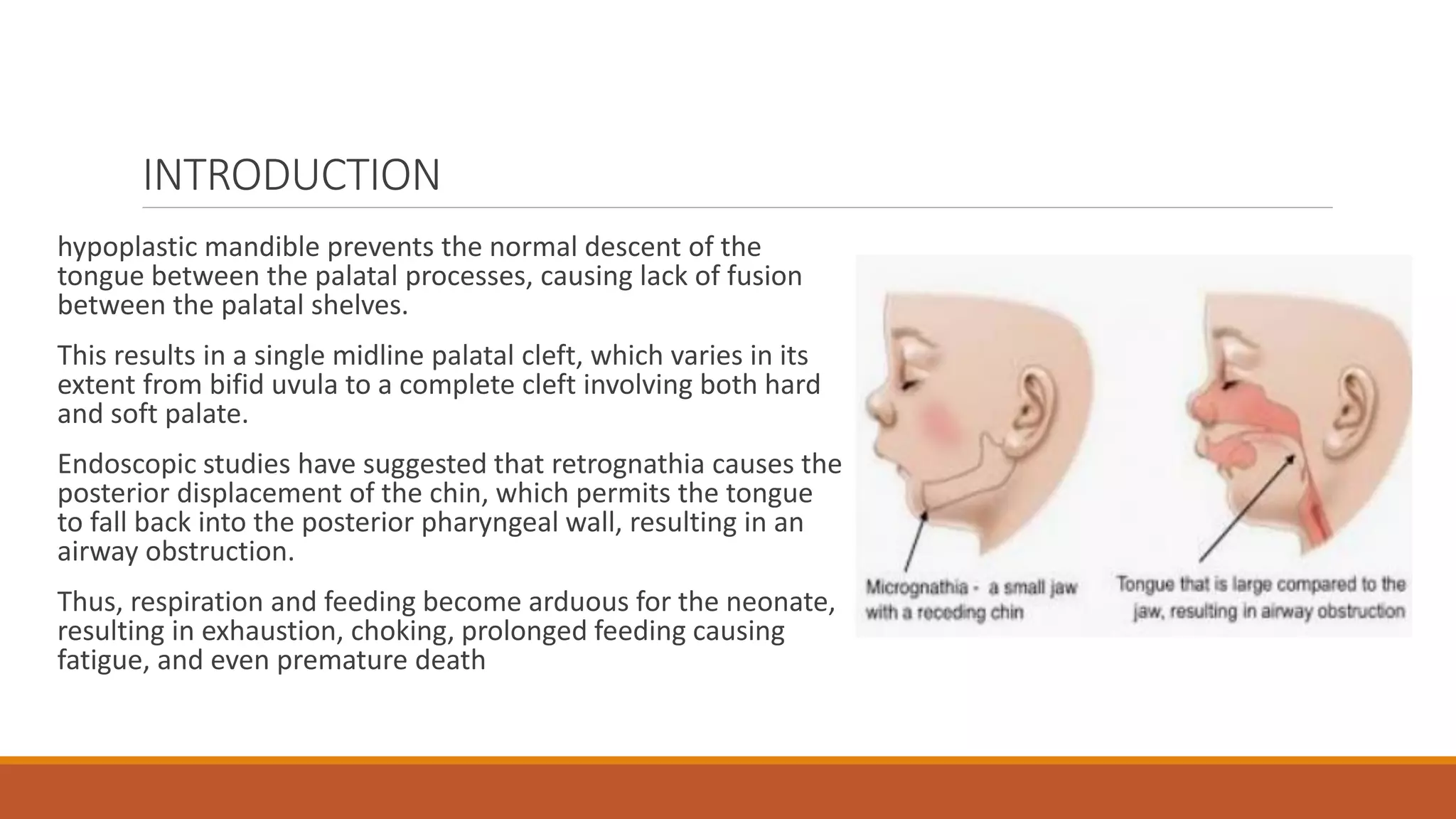 JOURNAL CLUB PRESENTATION IN PROSTHODONTICS ON FEEDING APPLIANCES USED ...