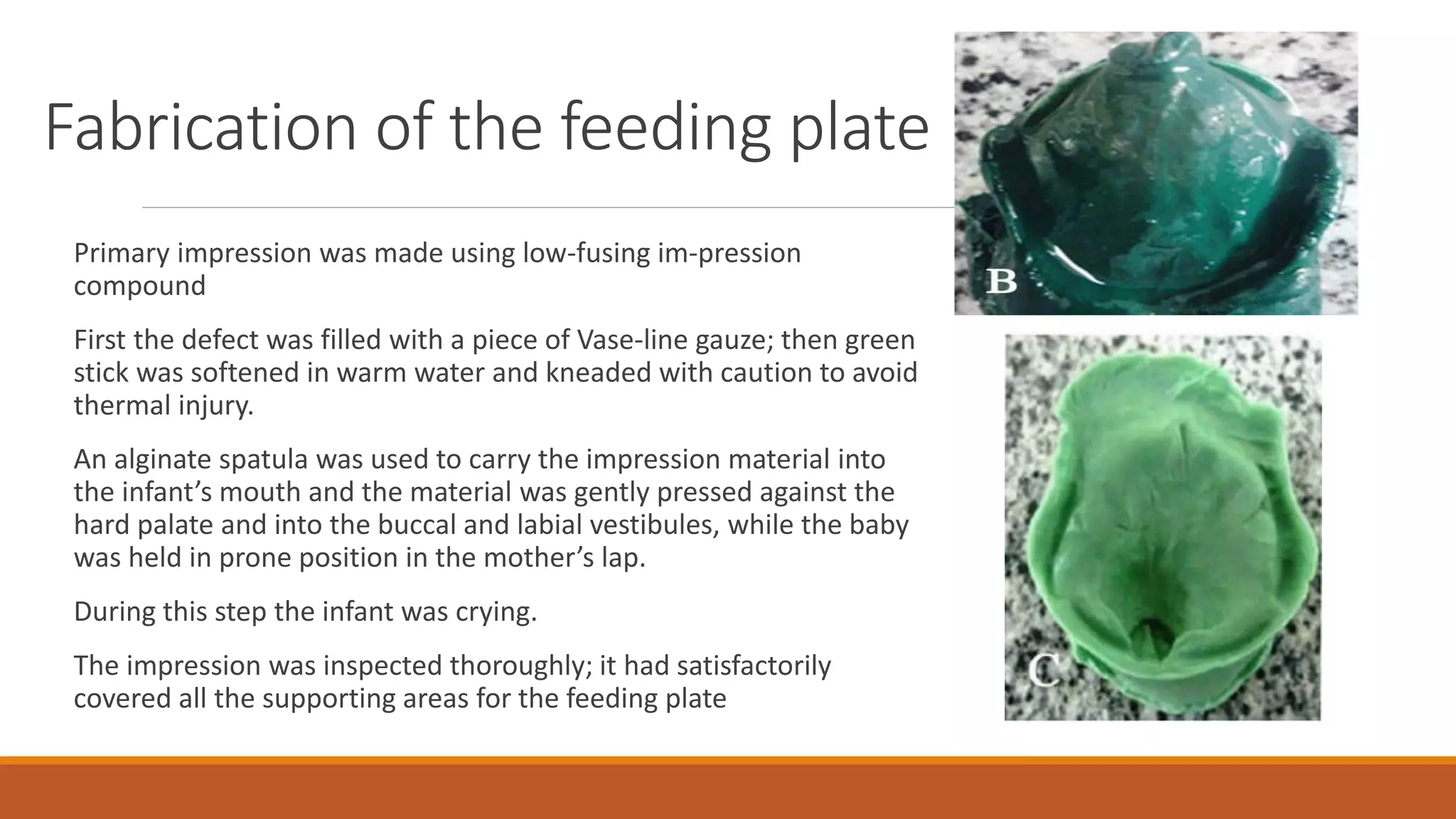 JOURNAL CLUB PRESENTATION IN PROSTHODONTICS ON FEEDING APPLIANCES USED ...