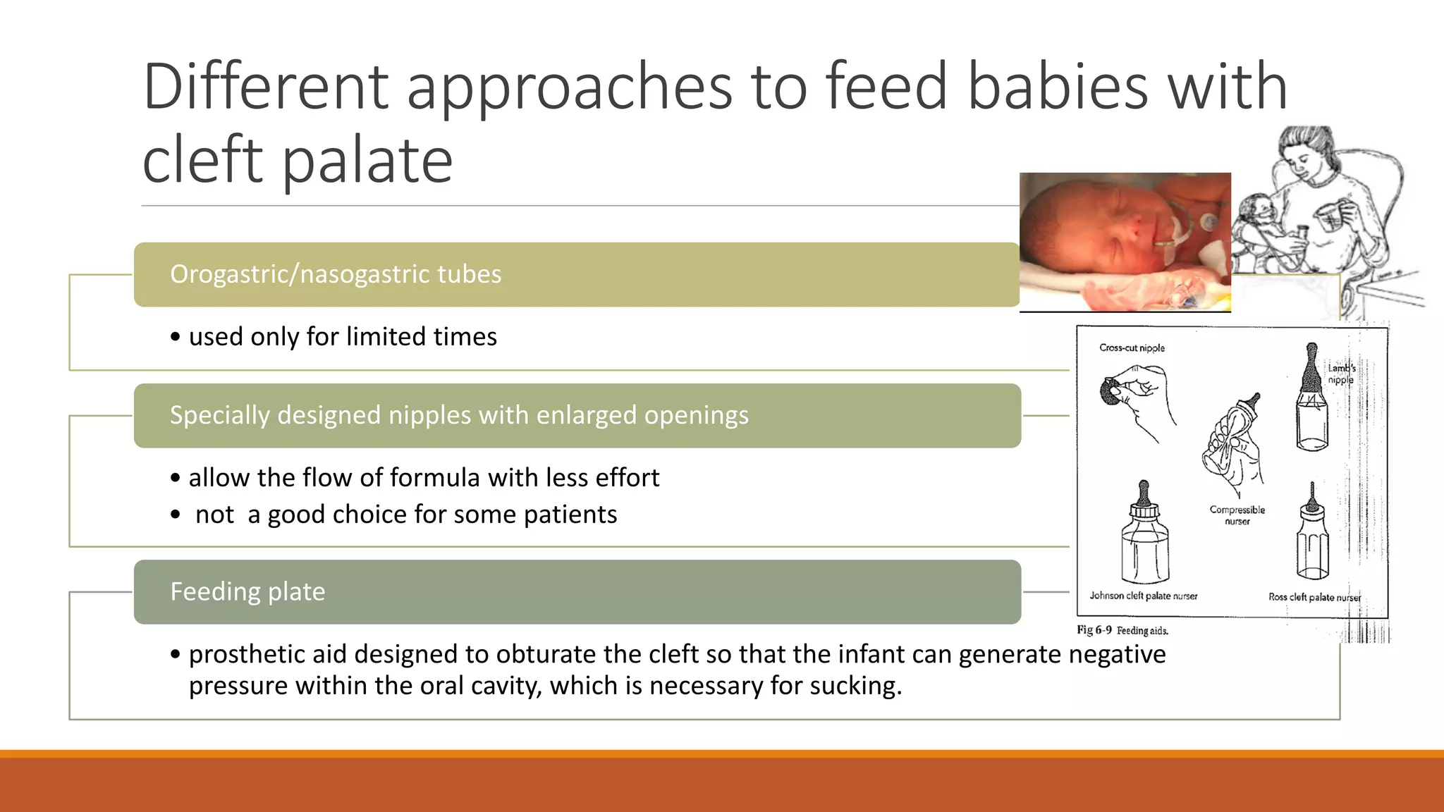 JOURNAL CLUB PRESENTATION IN PROSTHODONTICS ON FEEDING APPLIANCES USED ...