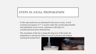 ENDOCROWNS AN INNOVATIVE APPROACH, INDICATION AND ADVANTAGES ...