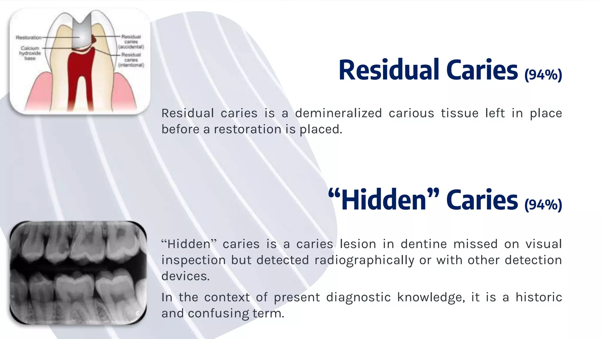JOURNAL CLUB: Terminology of Dental Caries and Dental Caries Management ...