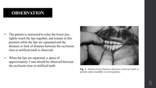 clinical measurement and evaluation of vertical dimension.pptx