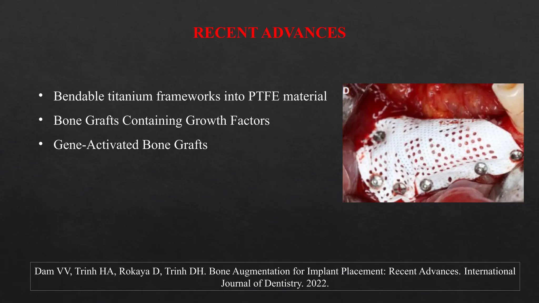 JC BONE AUMENTATION IS SO GOOD AND SO COOL | PPTX