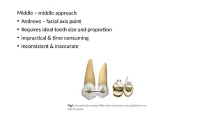 JC Bracket positioning in orthodontics.pptx