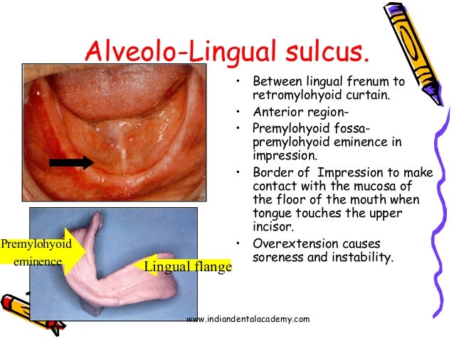 Denture border evaluation /certified fixed orthodontic courses by Ind…