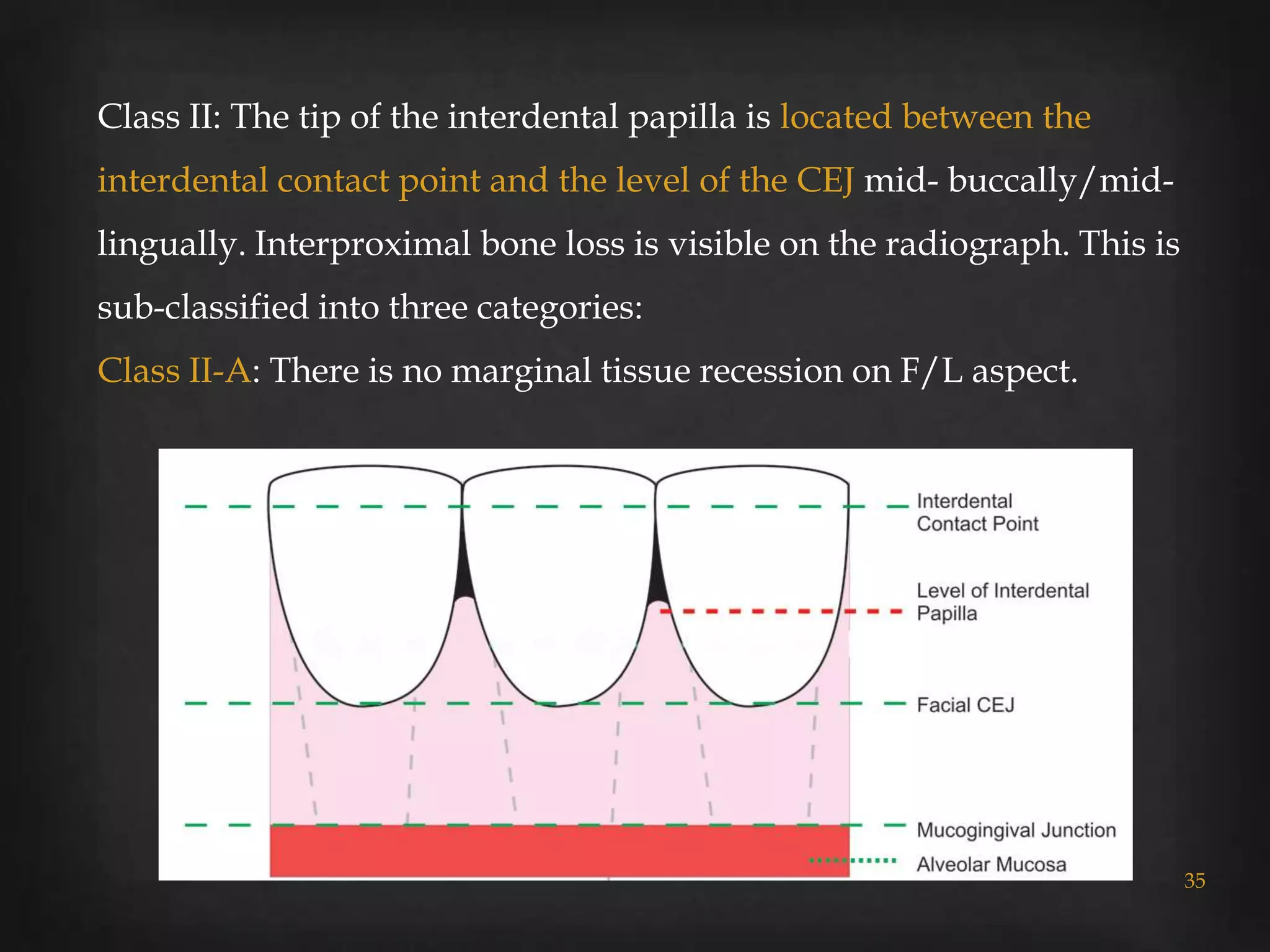 Gingival recession classifications | PPTX