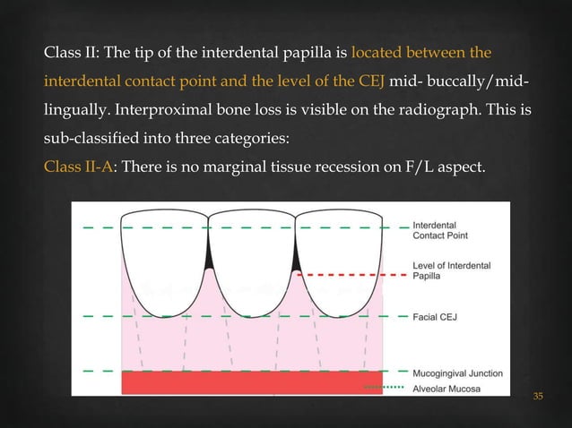 Gingival recession classifications | PPTX | Dental Health | Diseases ...
