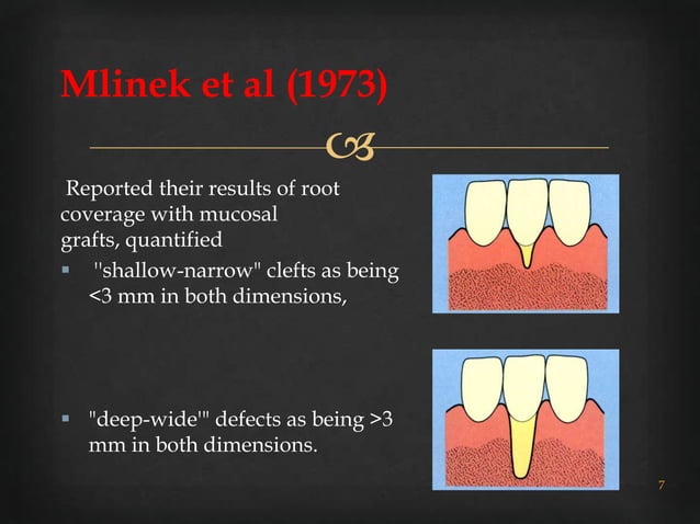 Gingival recession classifications | PPTX | Dental Health | Diseases ...