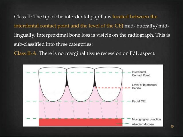 Gingival recession classifications